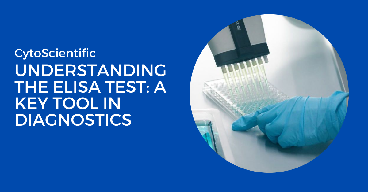 Understanding the ELISA Test: A Key Tool in Diagnostics
